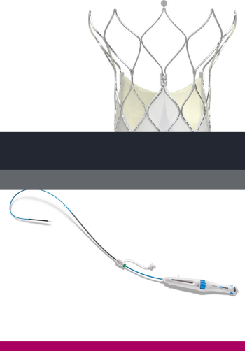 Abbott Navitor™ TAVI system - Amritt, Inc.