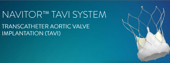 Abbott Launches Valve to Treat Aortic Stenosis in India - Amritt, Inc.
