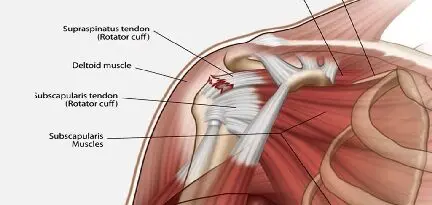 Stryker Launches InSpace Balloon Implant in India - Amritt, Inc.